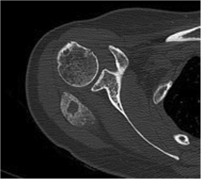 Radiological identification and analysis of soft tissue musculoskeletal ...