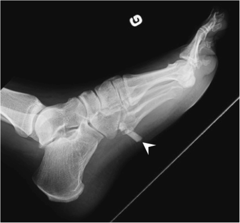 Radiological identification and analysis of soft tissue musculoskeletal ...