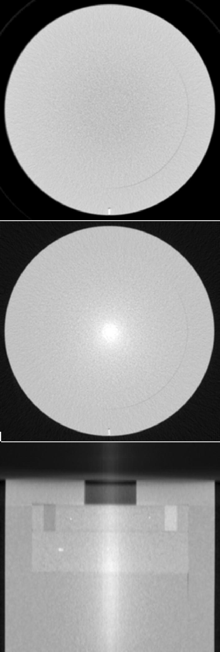 Image quality improvement for medium and large field of view Elekta XVI ...