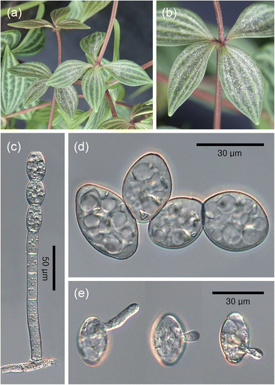 First record of Podosphaera xanthii on Peperomia tetragona | SpringerLink