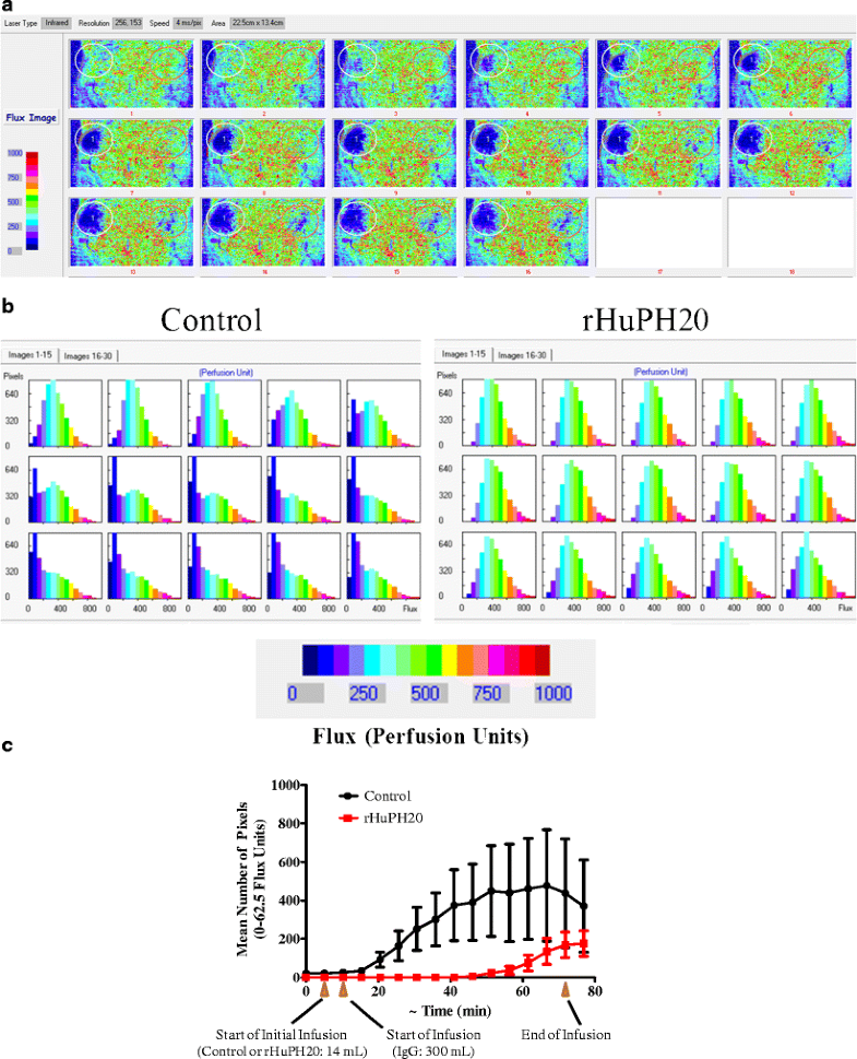 Recombinant human hyaluronidase PH20 (rHuPH20) facilitates subcutaneous ...