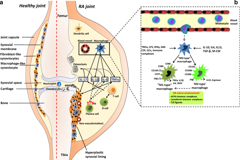 The folate receptor β as a macrophage-mediated imaging and therapeutic ...