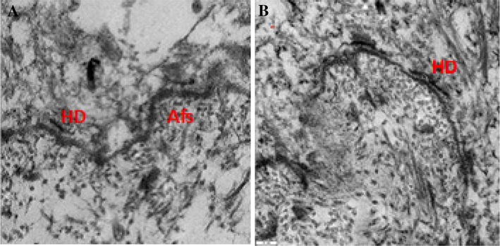 Integra®-Dermal Regeneration Template and Split-Thickness Skin Grafting ...