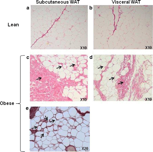 Fibrosis as a Cause or a Consequence of White Adipose Tissue ...