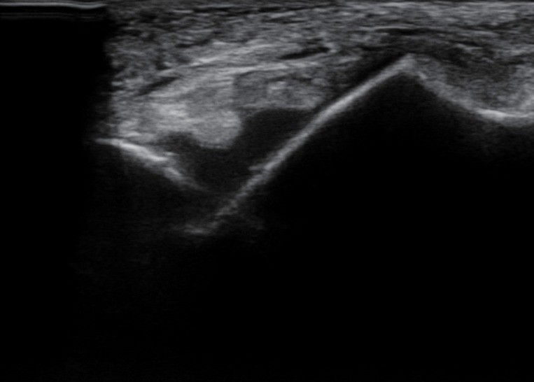 Sonografische Diagnostik an Sprunggelenk und Fuß | SpringerLink