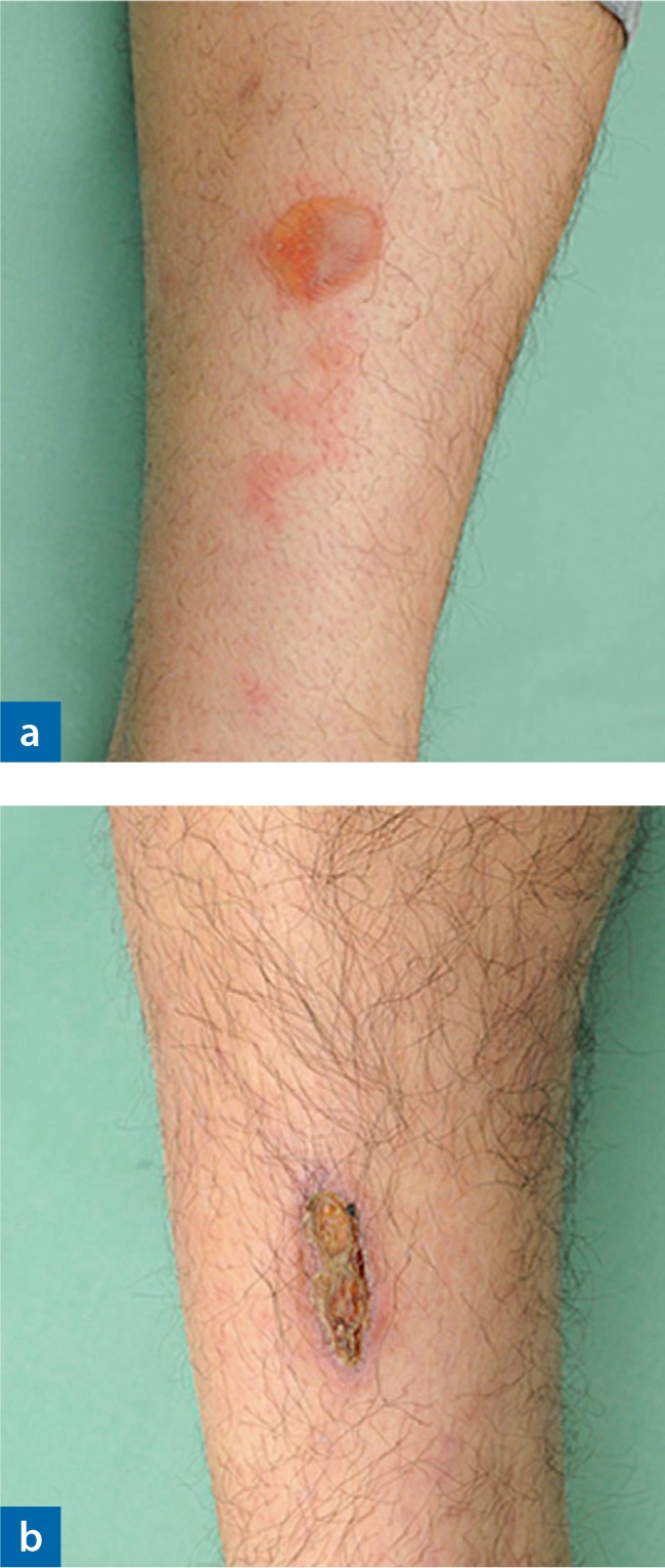 Welche Verdachtsdiagnose stellen Sie? | SpringerLink