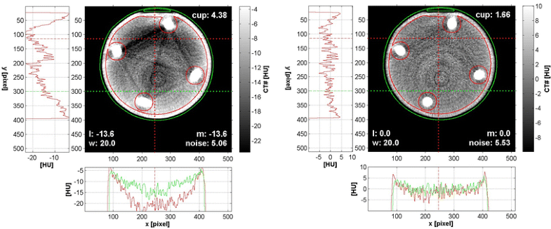 State of the Art of CT Detectors and Sources: A Literature Review ...