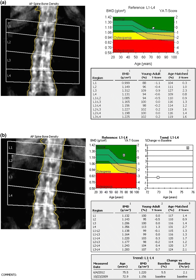 A Practical Approach to Interpretation of Dual-Energy X-ray ...