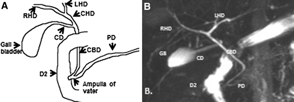 Role of CT and MRCP in Evaluation of Biliary Tract Obstruction ...
