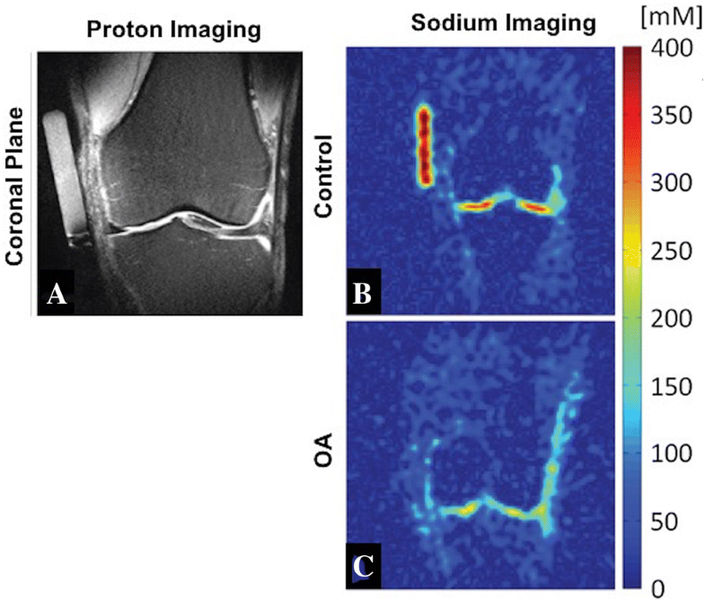 The Emerging Role of 7 Tesla MRI in Musculoskeletal Imaging | SpringerLink