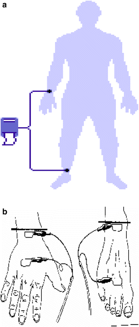Bioimpedance Vector Analysis (BIVA) for Diagnosis and Management of ...