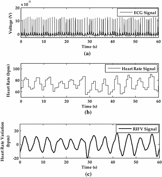 Respiratory Rate Estimation by Using ECG, Impedance, and Motion Sensing ...