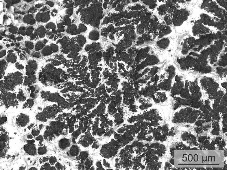 Chunky Graphite in Ferritic Spheroidal Graphite Cast Iron: Formation ...
