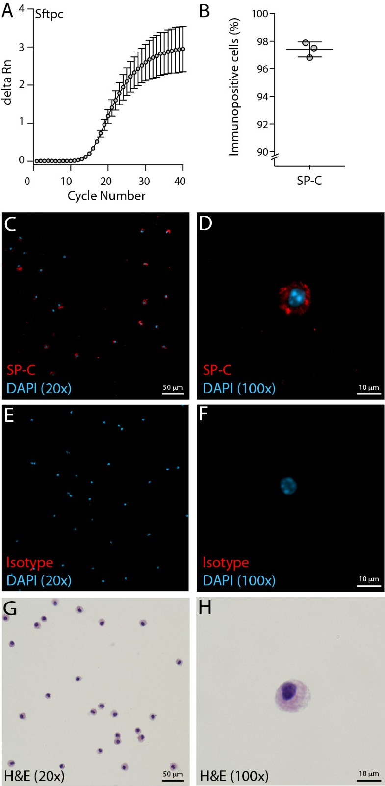 LysoTracker is a marker of differentiated alveolar type II cells ...