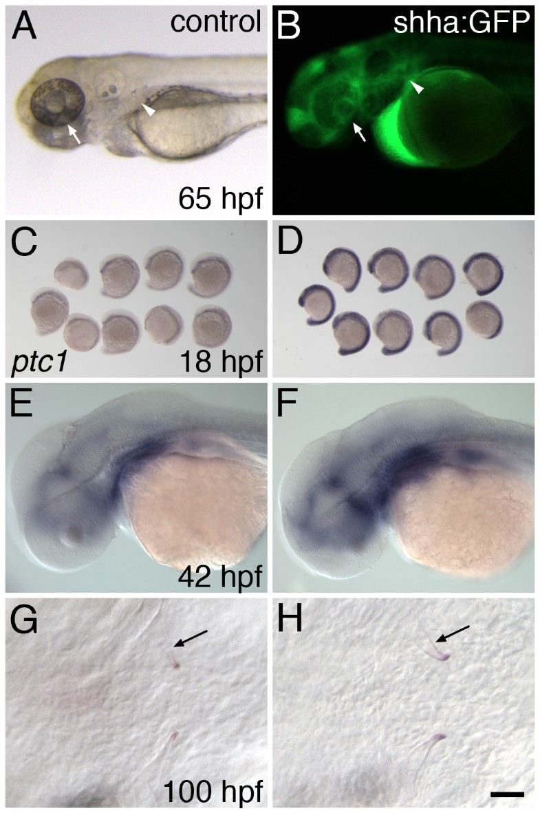 Hedgehog signaling is required at multiple stages of zebrafish tooth ...
