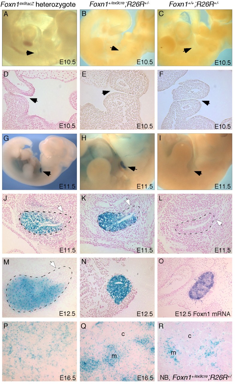 Specific expression of lacZ and cre recombinase in fetal thymic ...