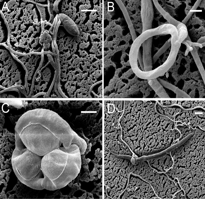 Drechslerella stenobrocha genome illustrates the mechanism of ...