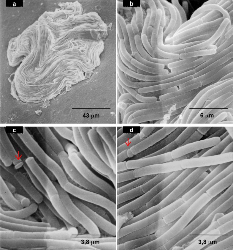 Colony shape as a genetic trait in the pattern-forming Bacillus ...