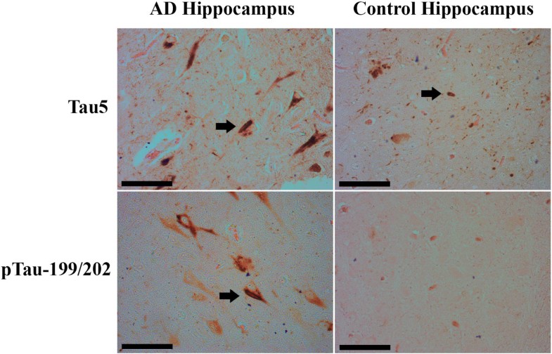 Hirano bodies differentially modulate cell death induced by tau and the ...