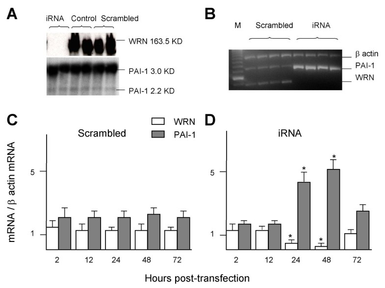 WRN polymorphisms affect expression levels of plasminogen activator ...