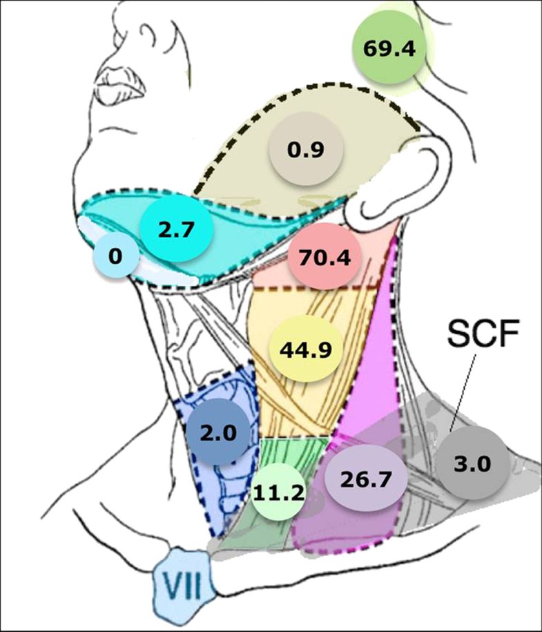 Patterns of regional lymph node metastasis of nasopharyngeal carcinoma ...