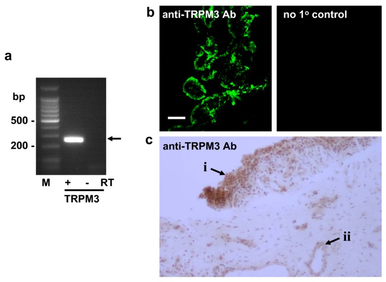 TRPM3 channel stimulated by pregnenolone sulphate in synovial ...