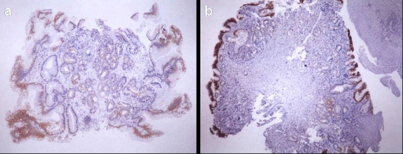 The utility of cytokeratins 7 and 20 (CK7/20) immunohistochemistry in ...