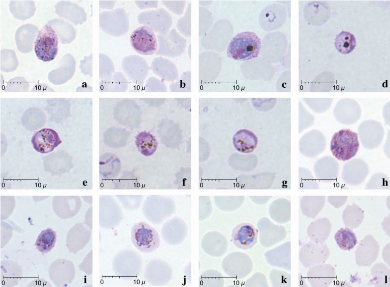 Morphological features and differential counts of Plasmodium knowles i ...