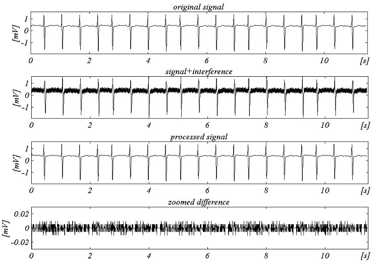 Removal of power-line interference from the ECG: a review of the ...