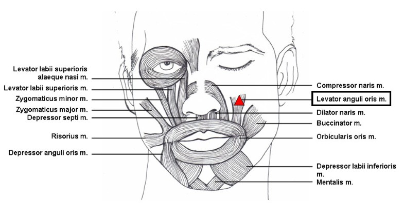 Levator anguli oris muscle based flaps for nasal reconstruction ...