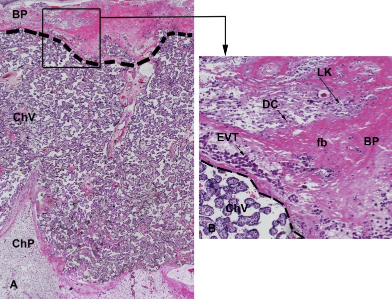 The term basal plate of the human placenta as a source of functional ...
