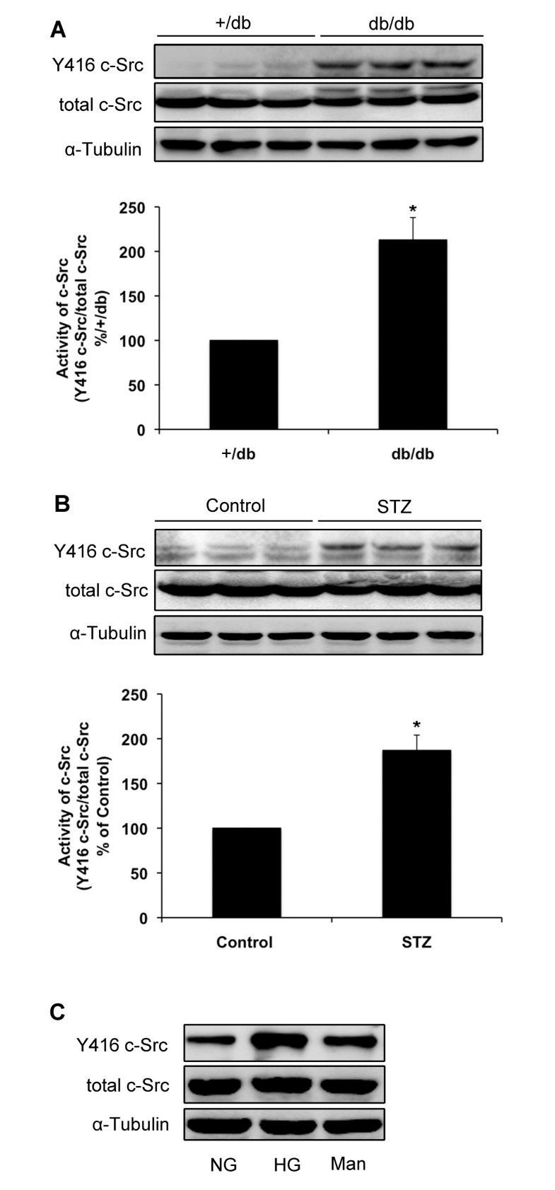 Connexin43 Mediates Nf κb Signalling Activation Induced By High Glucose