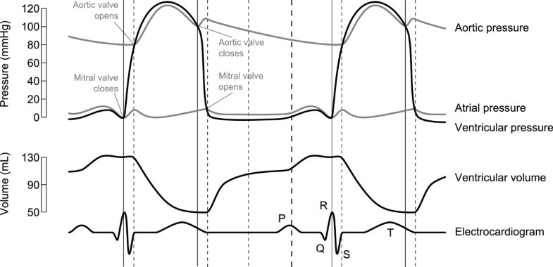 ECG-based gating in ultra high field cardiovascular magnetic resonance ...