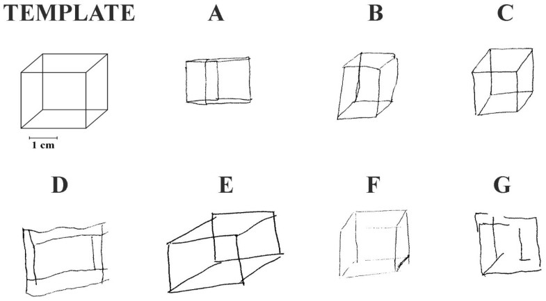 A standardized scoring method for the copy of cube test, developed to ...