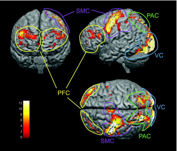 Activation of dorsolateral prefrontal cortex in a dual ...