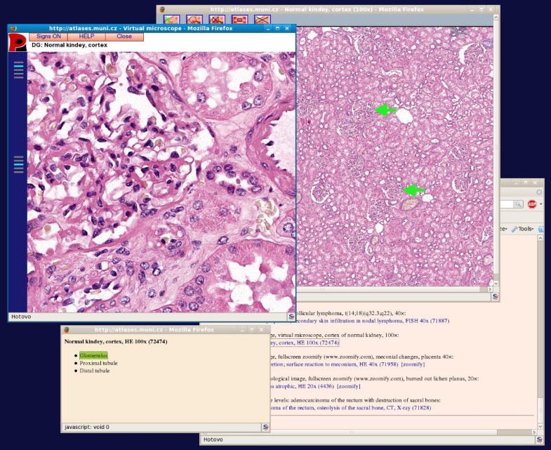 Virtual microscope interface to high resolution histological images ...