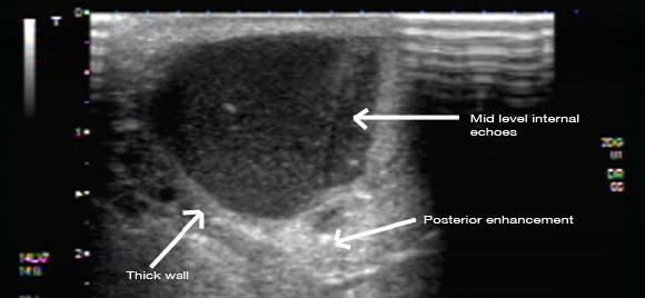 Ultrasound imaging of the lactating breast: methodology and application ...