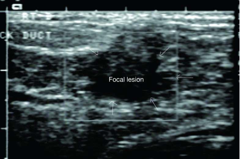 Ultrasound imaging of the lactating breast: methodology and application ...