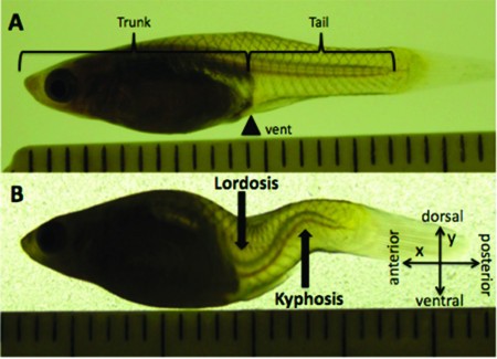 Structural and micro-anatomical changes in vertebrae associated with ...
