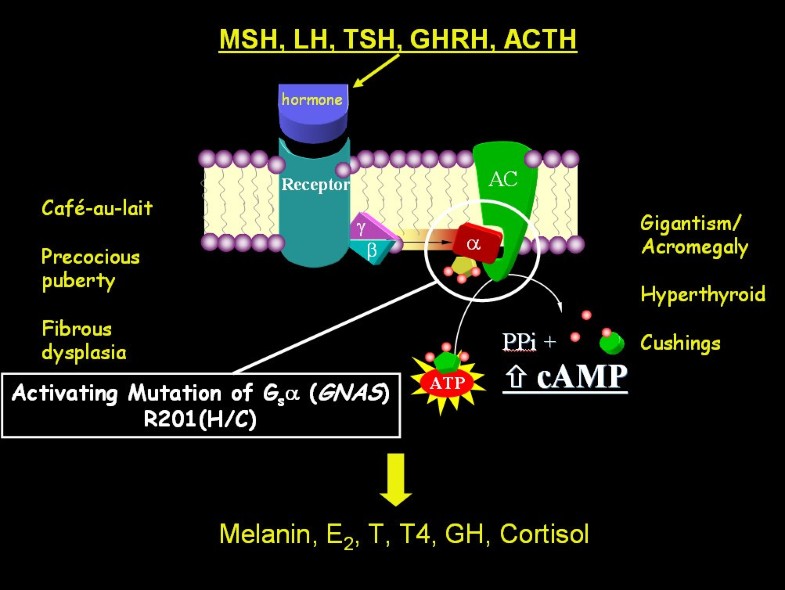 McCune-Albright syndrome | Orphanet Journal of Rare Diseases | Full Text