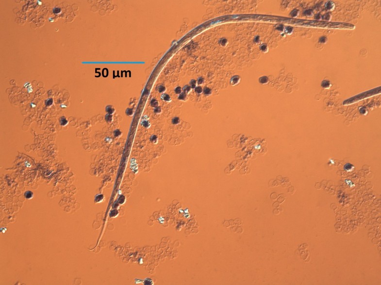 Dirofilaria repens infection in a dog imported to Norway | Acta ...
