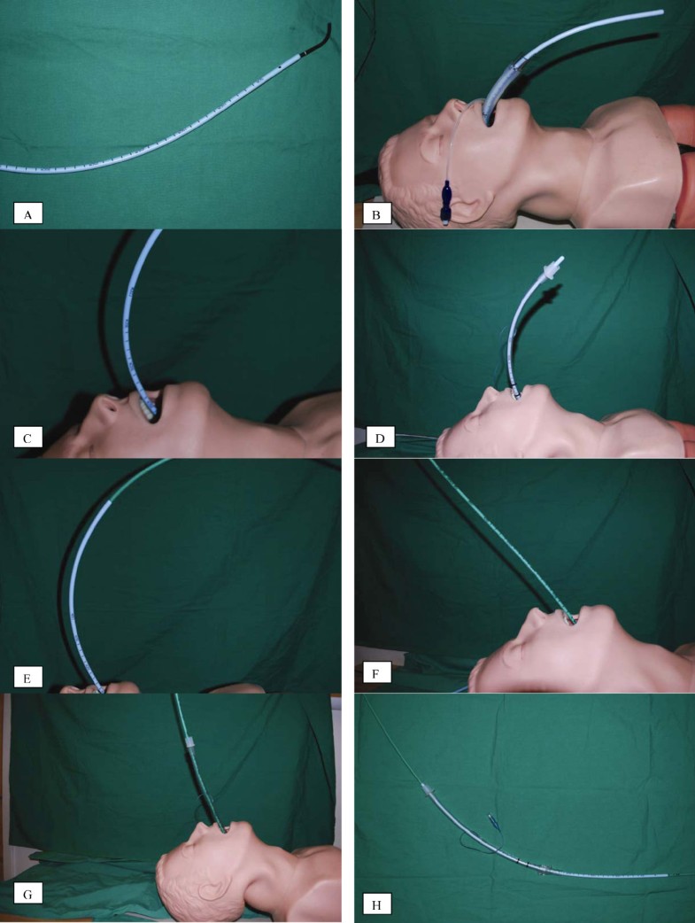 Novel use of an exchange catheter to facilitate intubation with an ...