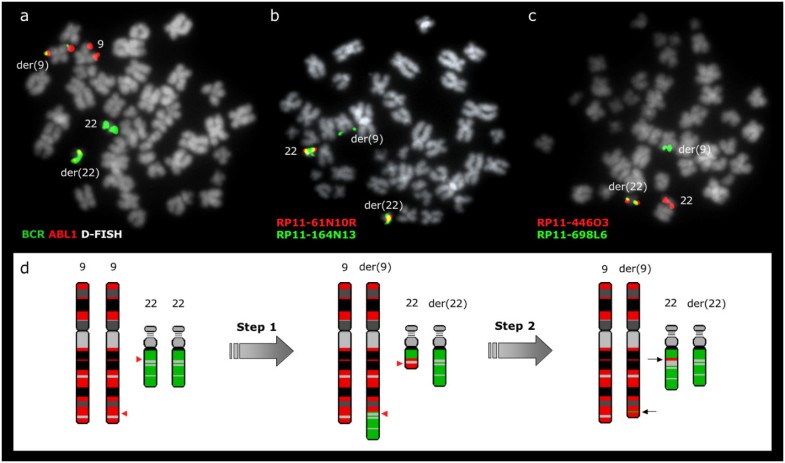 FISH mapping of Philadelphia negative BCR/ABL1 positive CML | Molecular ...