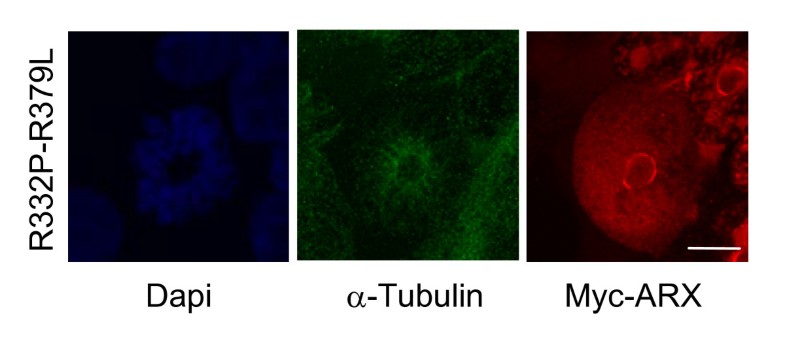 Mutations in the nuclear localization sequence of the Aristaless ...