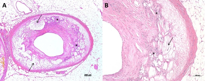 Chlamydia in canine or feline coronary arteriosclerotic lesions | BMC ...