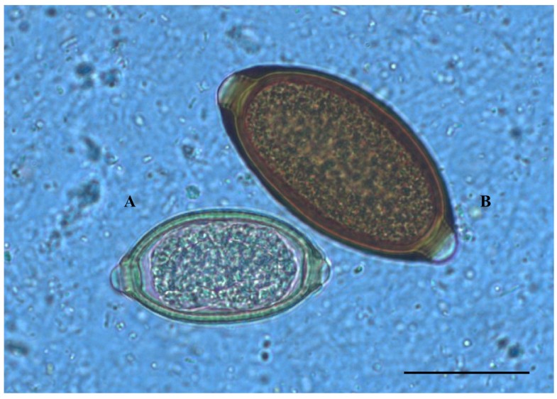 Mixed trichuroid infestation in a dog from Italy | Parasites & Vectors ...