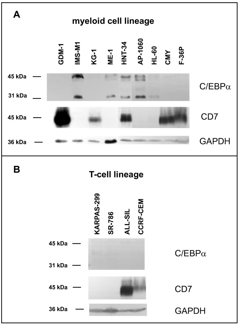 CD7 in acute myeloid leukemia: correlation with loss of wild-type CEBPA ...