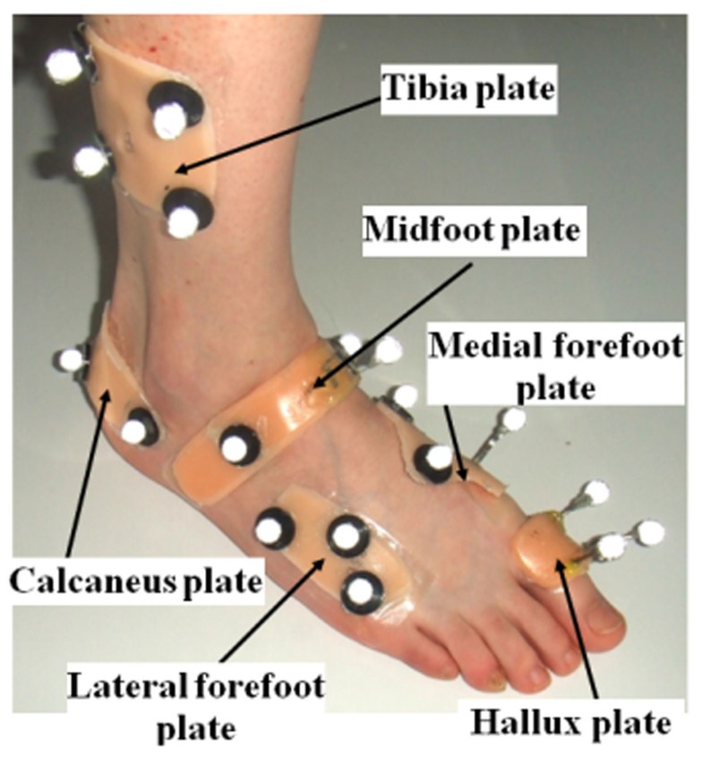 Association between foot types defined by static and dynamic measures ...