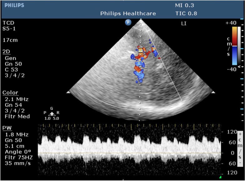 Prehospital stroke diagnostics based on neurological examination and ...