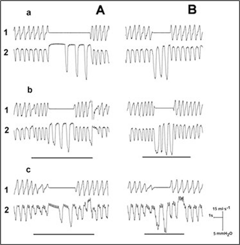 Cortical control of hering-breuer reflexes in anesthetized rats ...
